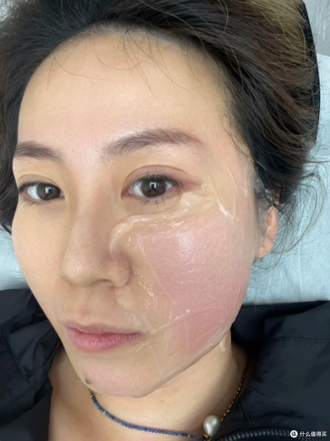 超声炮失败后脸会垮掉吗,超声炮术后护理和注意事项 面部皮肤管理 什么值得买